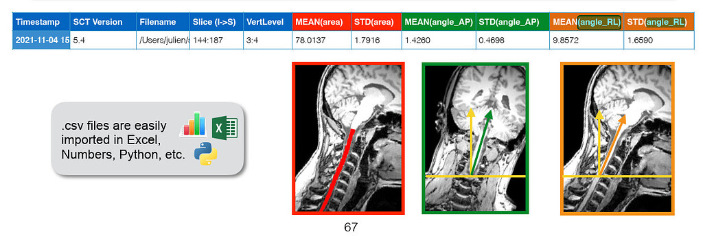 Sct_process_segmentation, angles - SCT - Spinalcordmri.org
