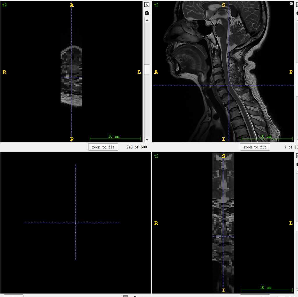 Multimodal registration - SCT - Spinalcordmri.org
